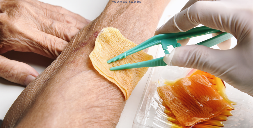 wound care dressings- dressings